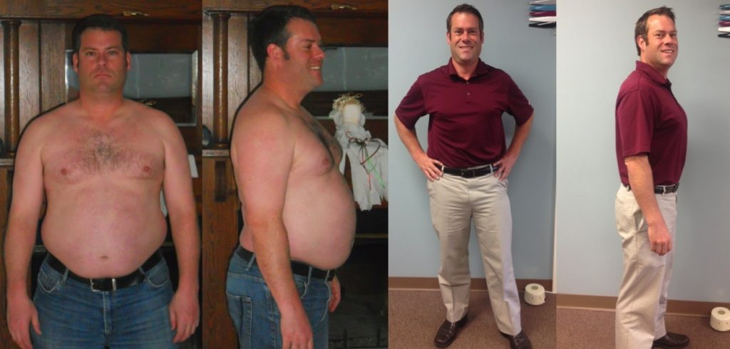 Before And After Archives - HCG Injections | HCG Drops | Weight Loss ...